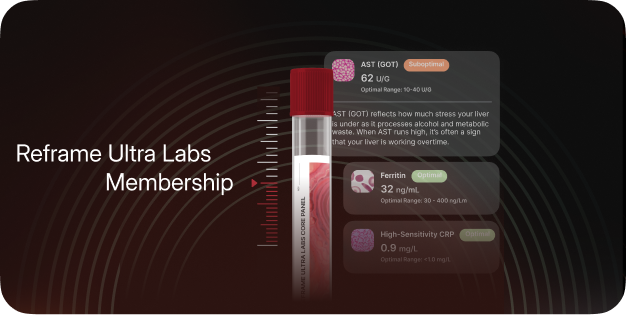 Ultra Labs Onboard
